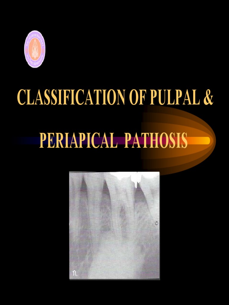 Classification of Pulpal & Periapical Pathosis | PDF | Bone | Health ...