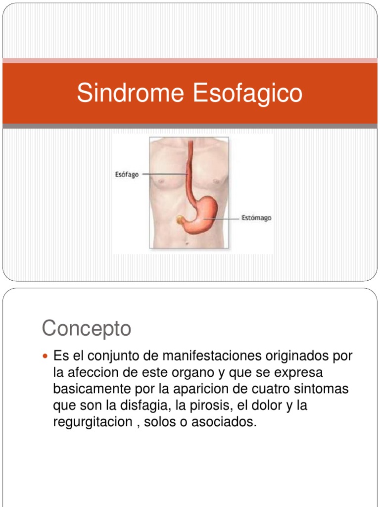 Sindrome Esofagico | PDF