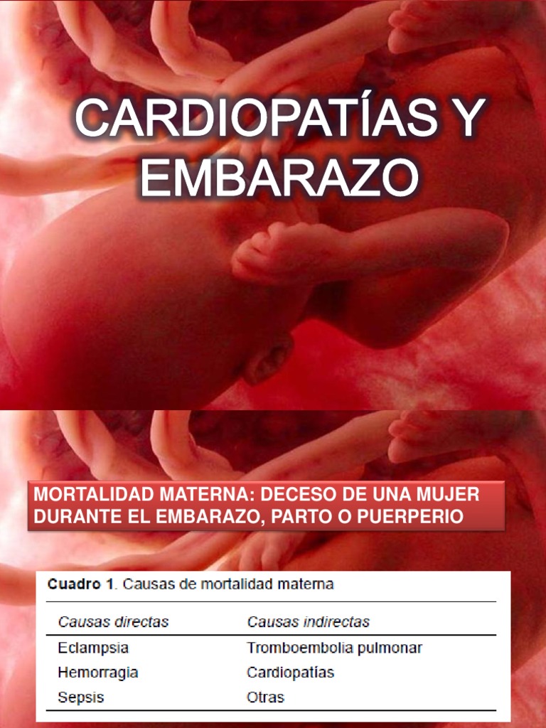 CardiopatÍas Y Embarazo Defecto Cardiaco Congenito Corazón Prueba