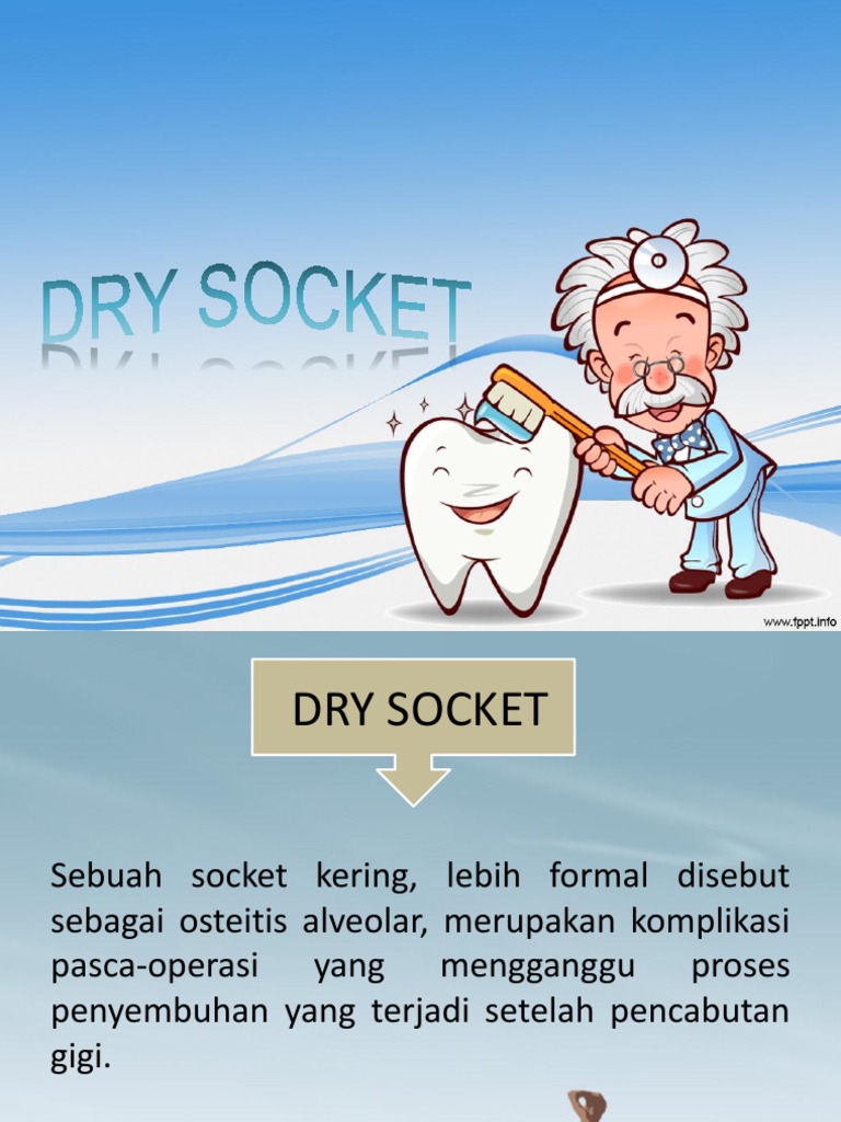 Dry Socket | PDF