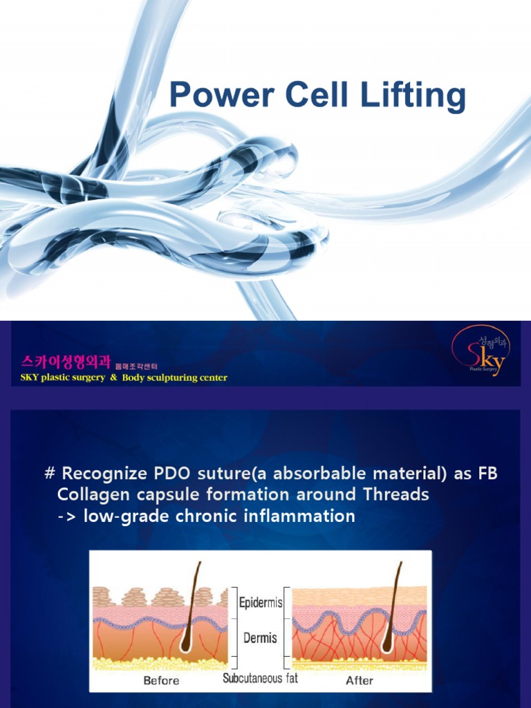 Power Cell Lifting (Threads) - SKY Plastic Surgery & Body Sculpturing ...