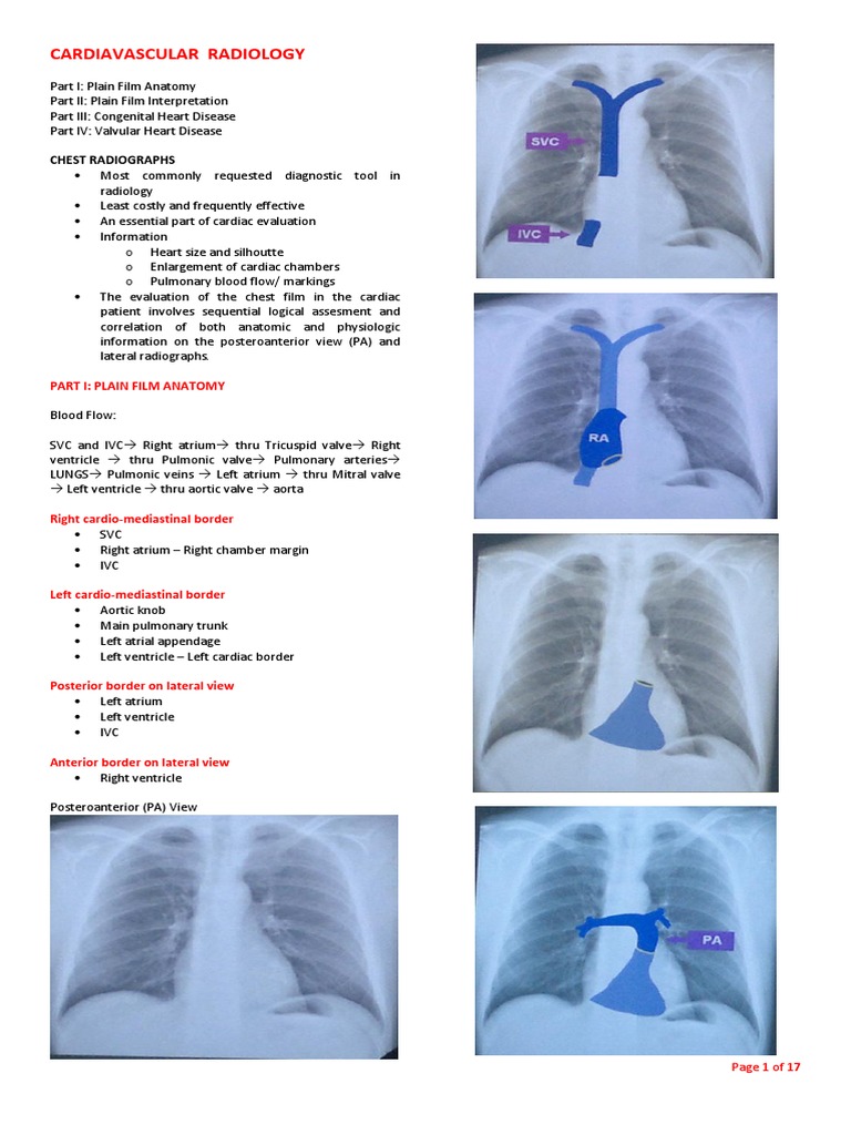 Cardiac Radiology | Atrium (Heart) | Heart