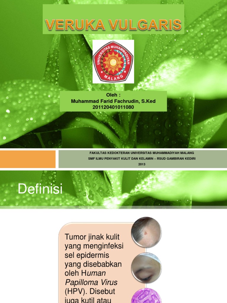 Veruka Vulgaris | PDF