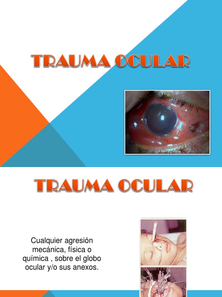 Trauma Ocular | PDF | Lesión | Ojo humano