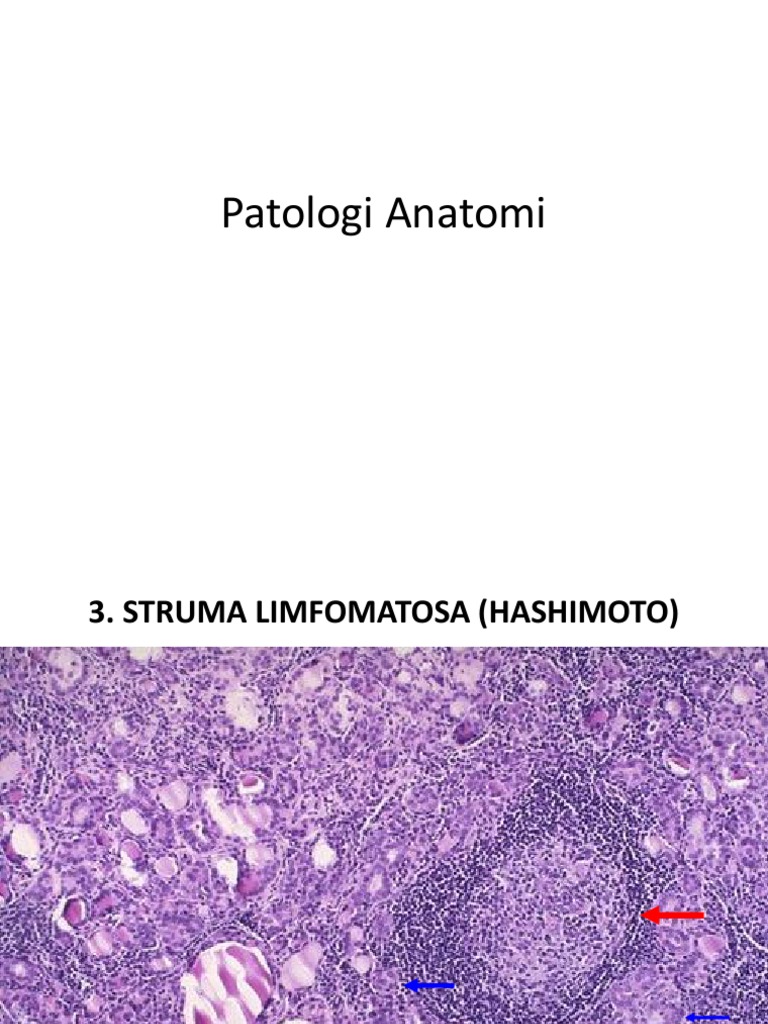 Patologi Anatomi | PDF