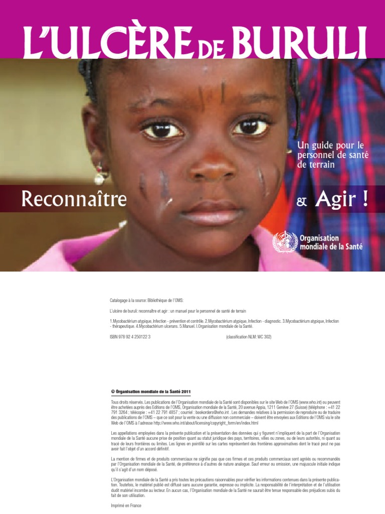 Ulcere de Buruli - Reconnaitre Et Agir | PDF | Antibiotiques ...