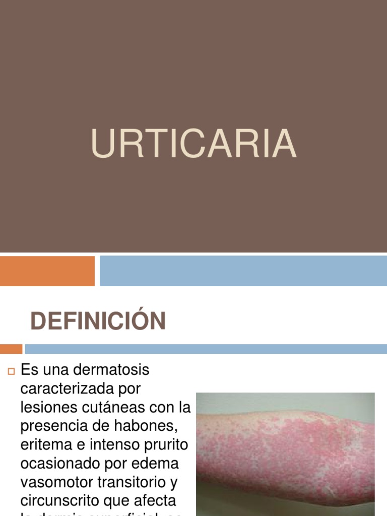 Tema 36 Urticaria | PDF | Enfermedades y trastornos | Medicina CLINICA