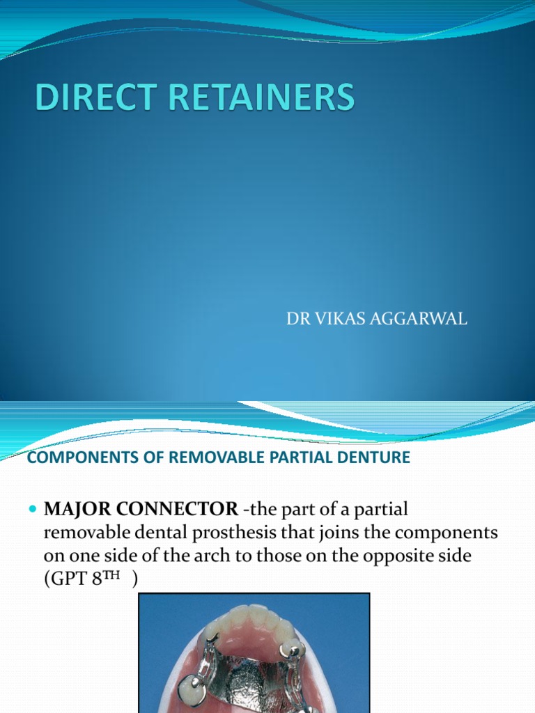 Direct Retainers in Removable Partial Dentures | PDF | Dentures | Mouth