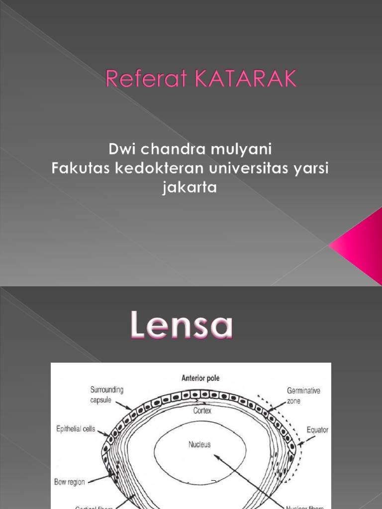 Referat Katarakppt