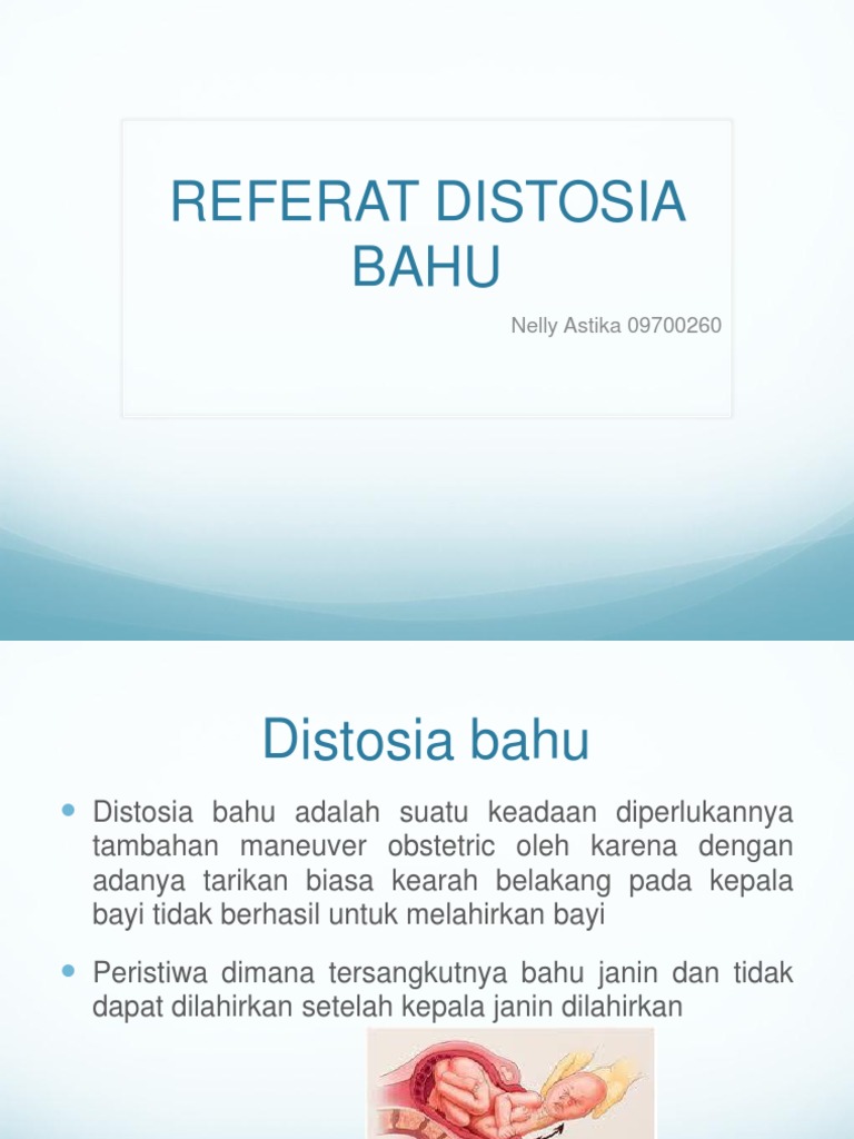 Distosia Bahu | PDF | Kesehatan Holistik