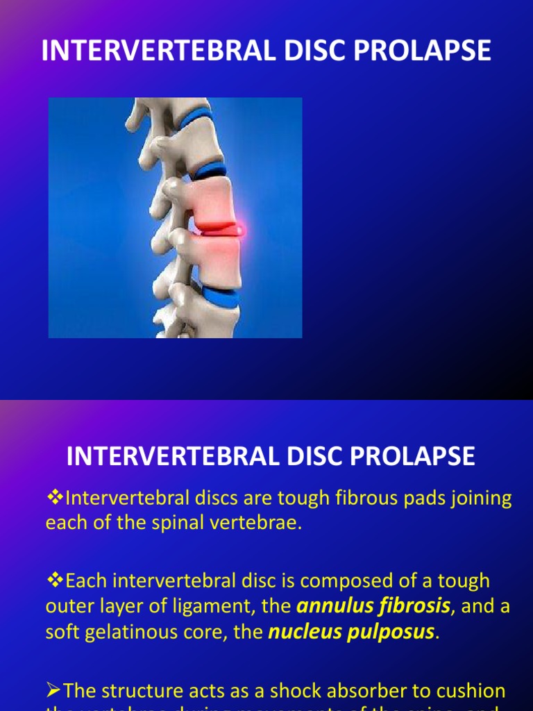 Intervertebral Disc Herniation