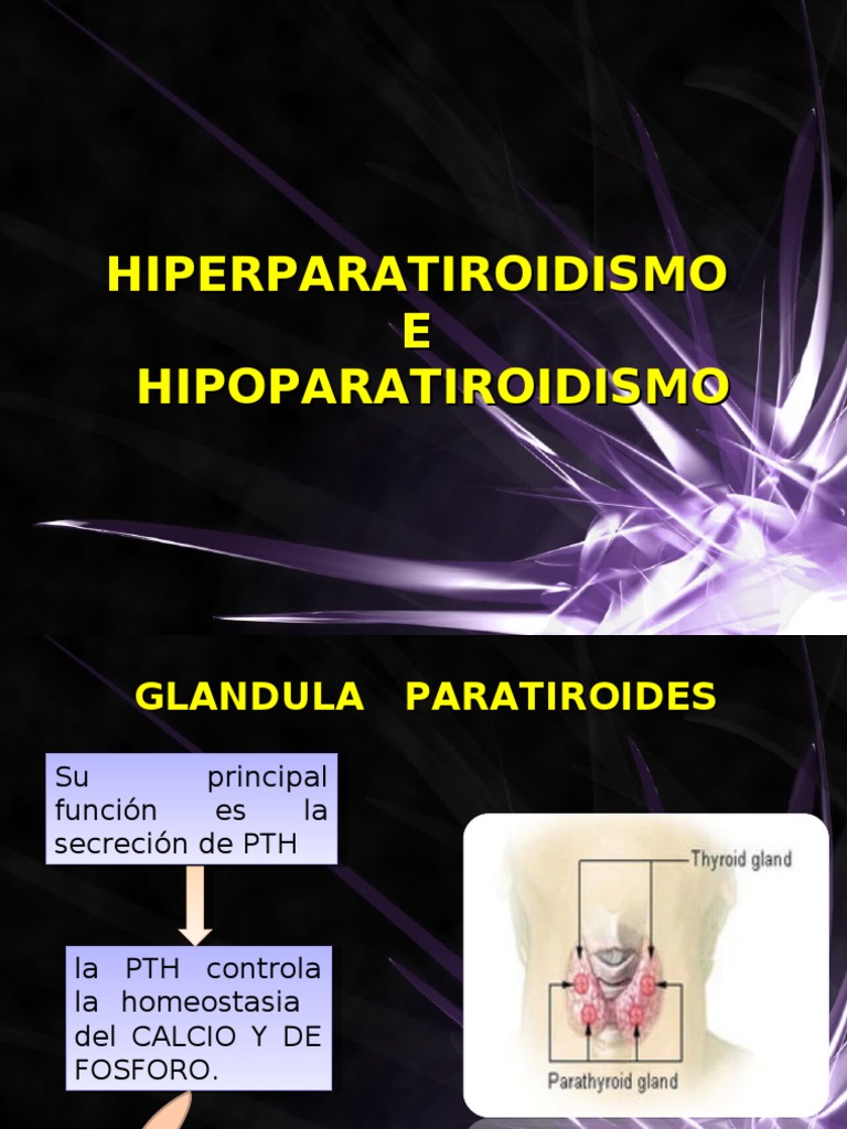 Hiperparatiroidismo