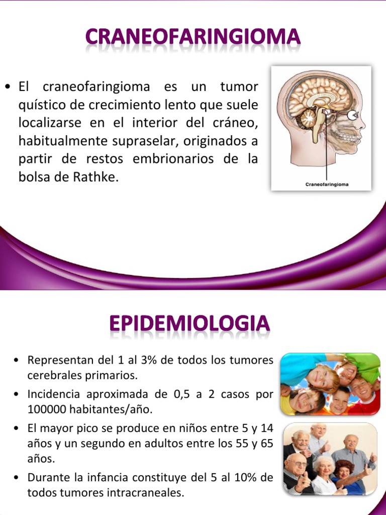 Craneofaringioma | PDF