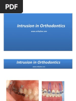 Meaw Technique | PDF | Orthodontics | Clinical Medicine