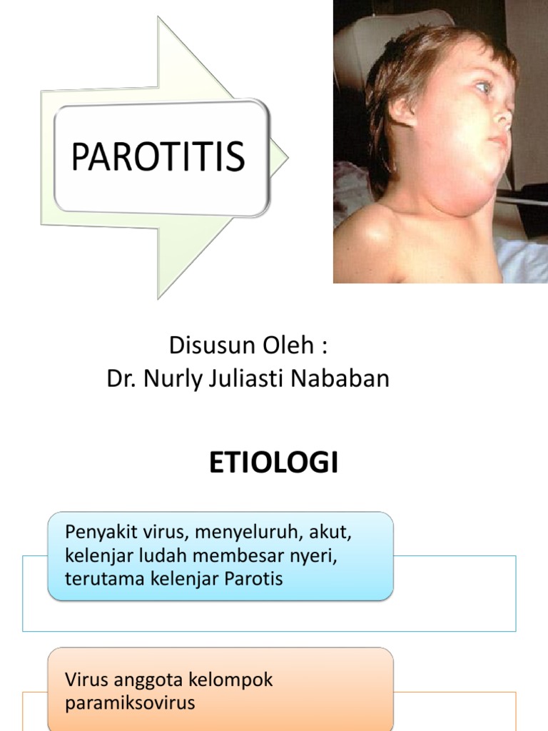 Parotitis | PDF
