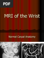 TFCC Lesions: Classification Guide | PDF | Joints | Human Anatomy