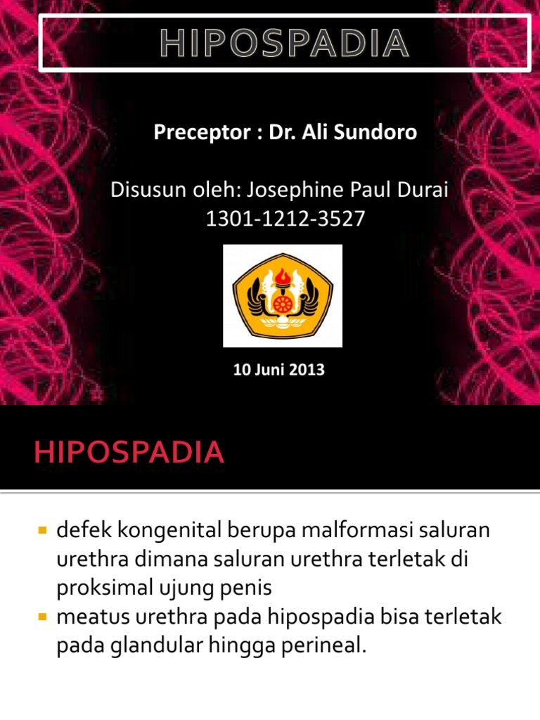HIPOSPADIA.ppt