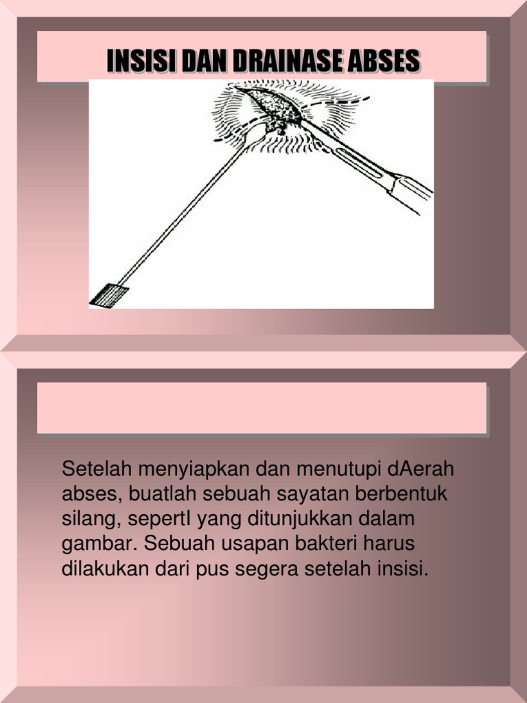 Insisi Dan Drainase | PDF