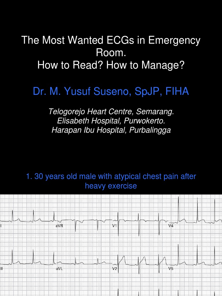 ECG in Emergency Room, How | Myocardial Infarction | Thorax