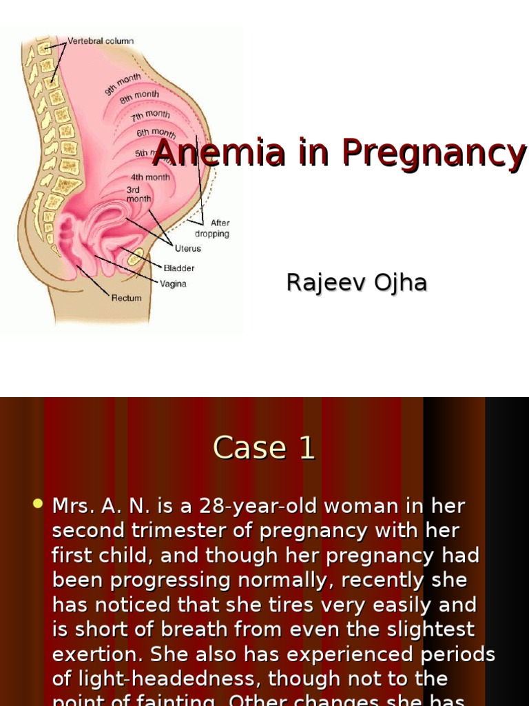 Anemia Pregnancy Anemia Clinical Medicine