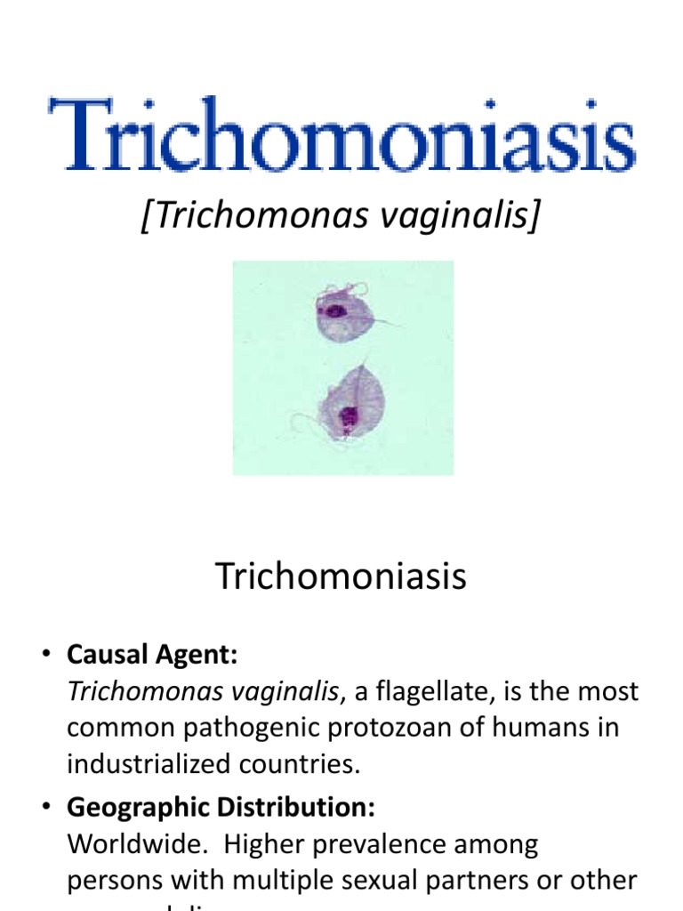 Trichomoniasis | PDF