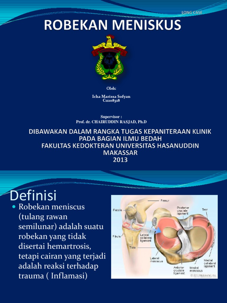 Robekan Meniscus | PDF
