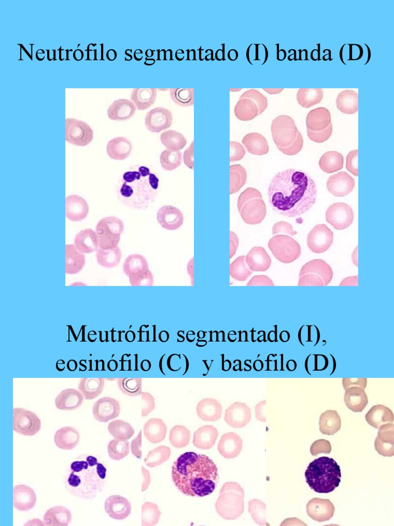 Neutrófilos De Banda