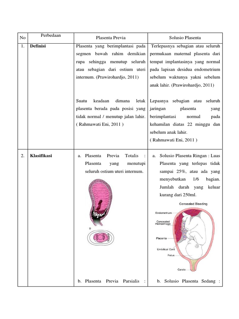 Plasenta Previa, Solusio Plasenta