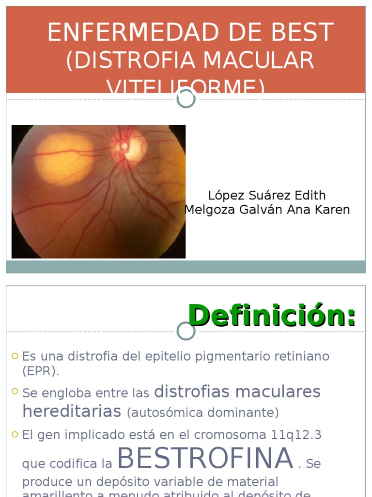Enfermedad de Best | PDF | Percepción visual | Ojo humano