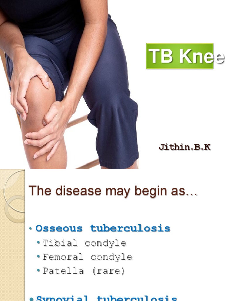 Tuberculosis of Knee | PDF | Knee | Clinical Medicine
