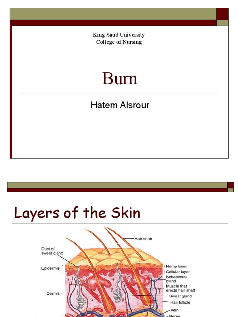 King Saud University College of Nursing | PDF | Burn | Intravenous Therapy