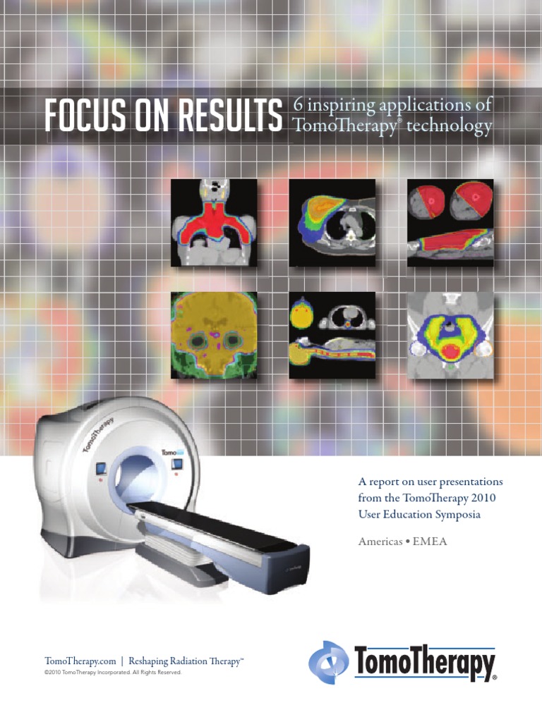 Applications of Tomotherapy PDF | PDF | Radiation Therapy | Neoplasms