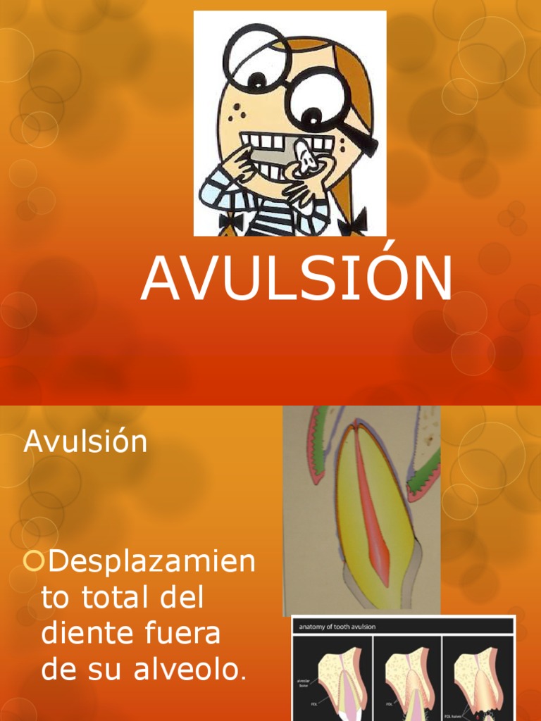 Manejo de la Avulsión Dental | PDF | Diente humano | Lesión
