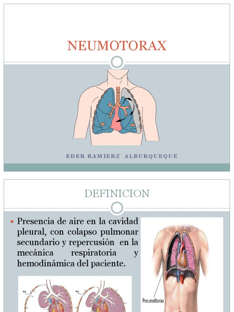 NEUMOTORAX Exposicion | PDF | Pulmón | Tos