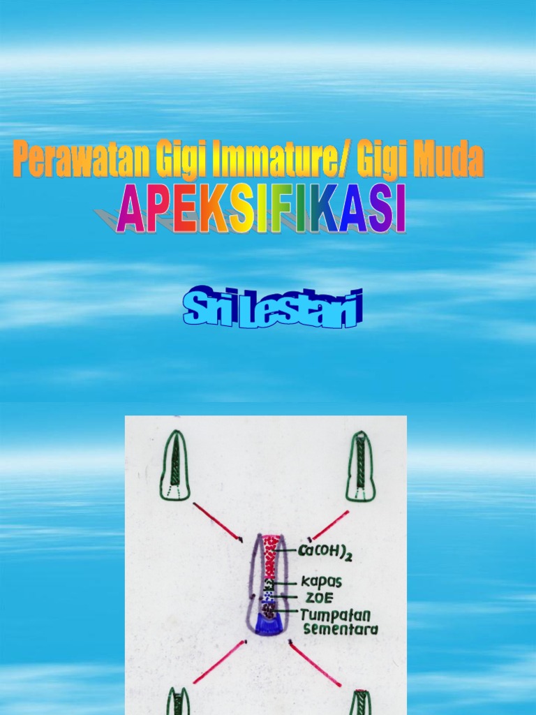 Apeksifikasi Dan Apeksogenesis | PDF
