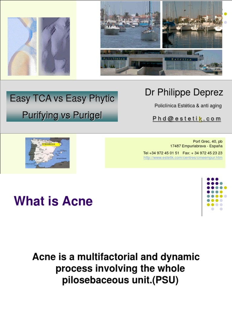 Acne VC Comedogenesis and Treatment | PDF | Acne Vulgaris | Dermatology