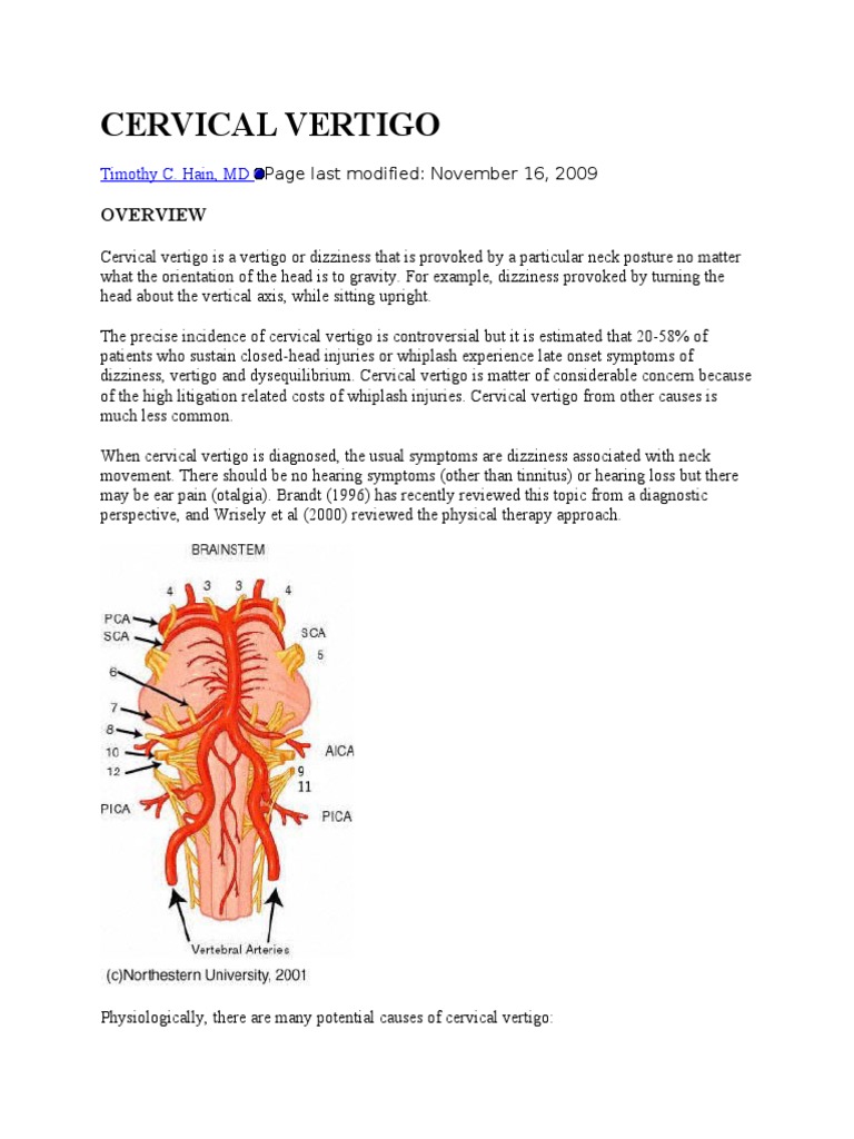Cervical Vertigo | Chiropractic | Angiography