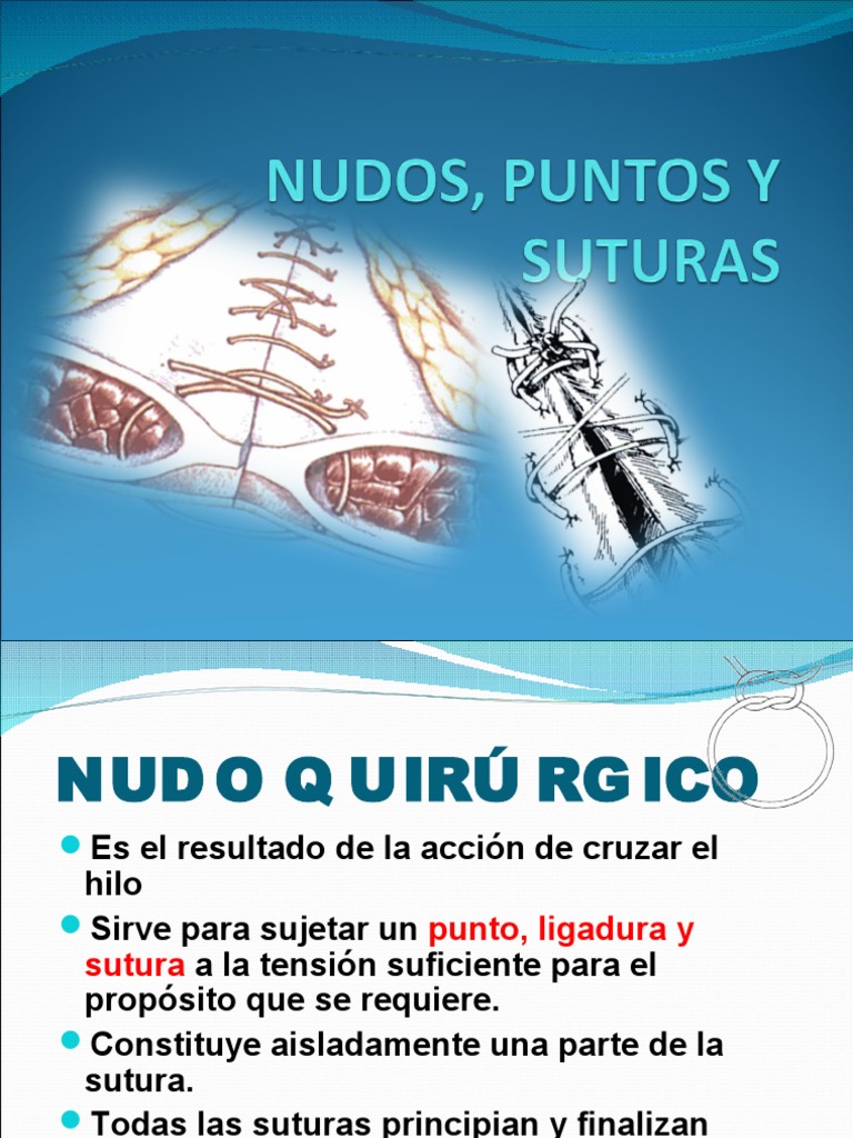 Nudos, Puntos y Suturas | PDF | Sutura Quirúrgica | Medicina CLINICA