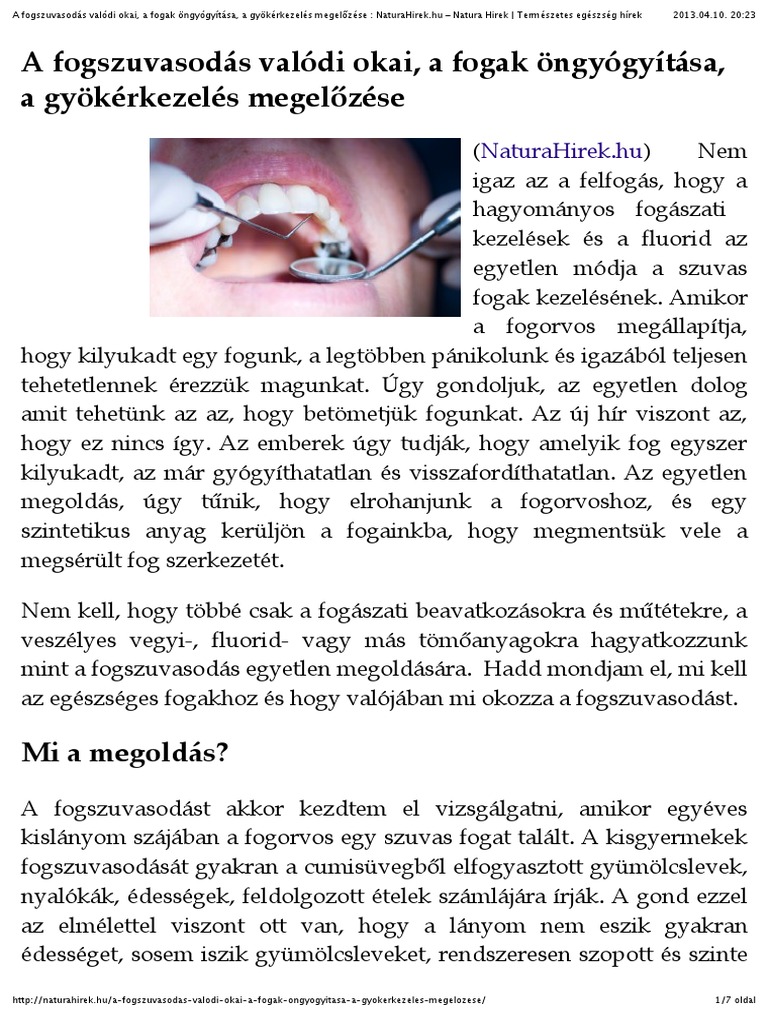 A Fogszuvasodás Valódi Okai, A Fogak Öngyógyítása, A Gyökérkezelés ...