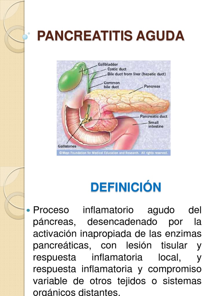 Presentacion Pancreatitis Aguda | PDF | Páncreas | Gastroenterología