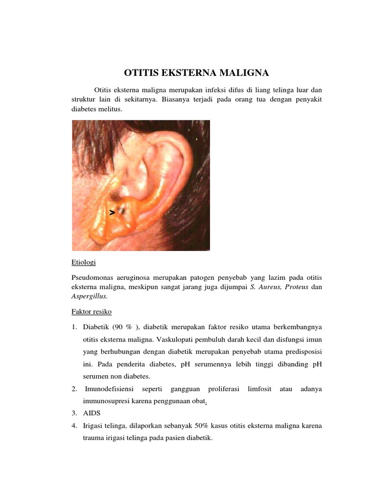 Otitis Eksterna Maligna | PDF