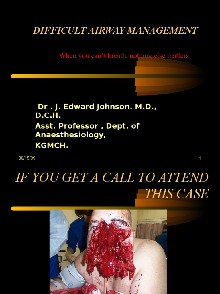 Difficult Airway Management | PDF | Human Head And Neck | Anesthesia