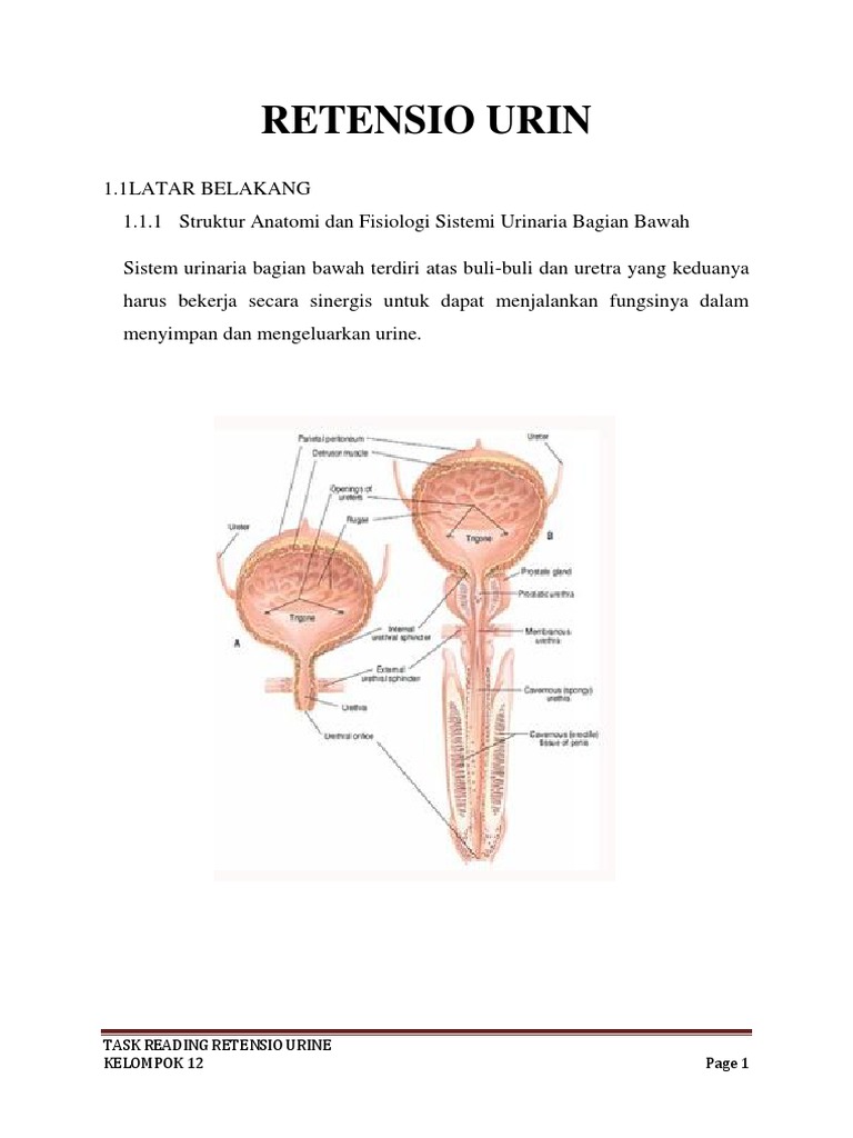 Retensio Urin | PDF