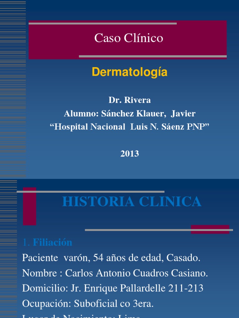 Caso Clinico Dermato-Vitiligo 2013 PNP | PDF | Psoriasis | Especialidades Medicas
