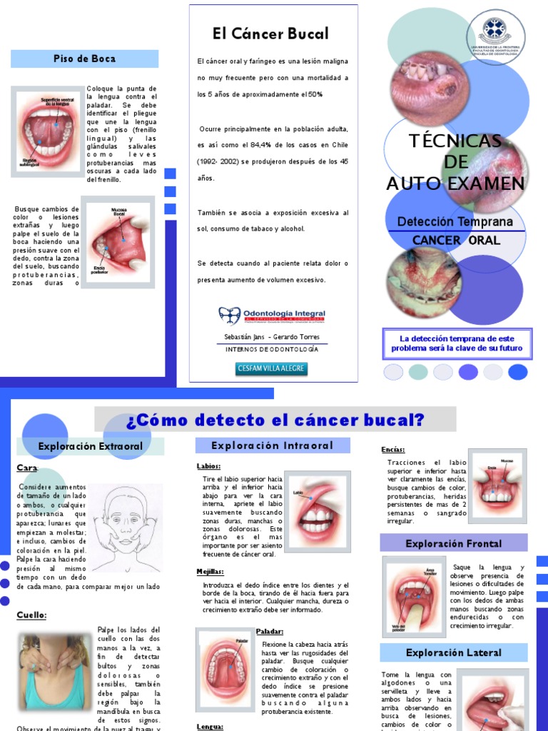 Cancer Oral Pdf Odontología Boca
