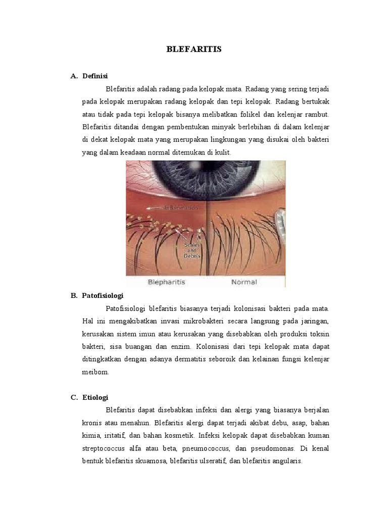 Penyakit Palpebra | PDF