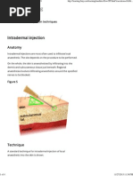 Local Infiltration and Field Block Anesthesia | PDF | Injection ...