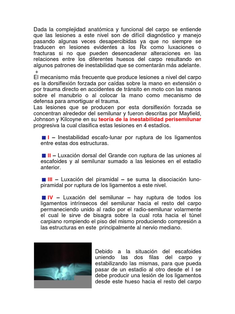 Visi Disi | PDF | Mano | Sistema musculoesquelético