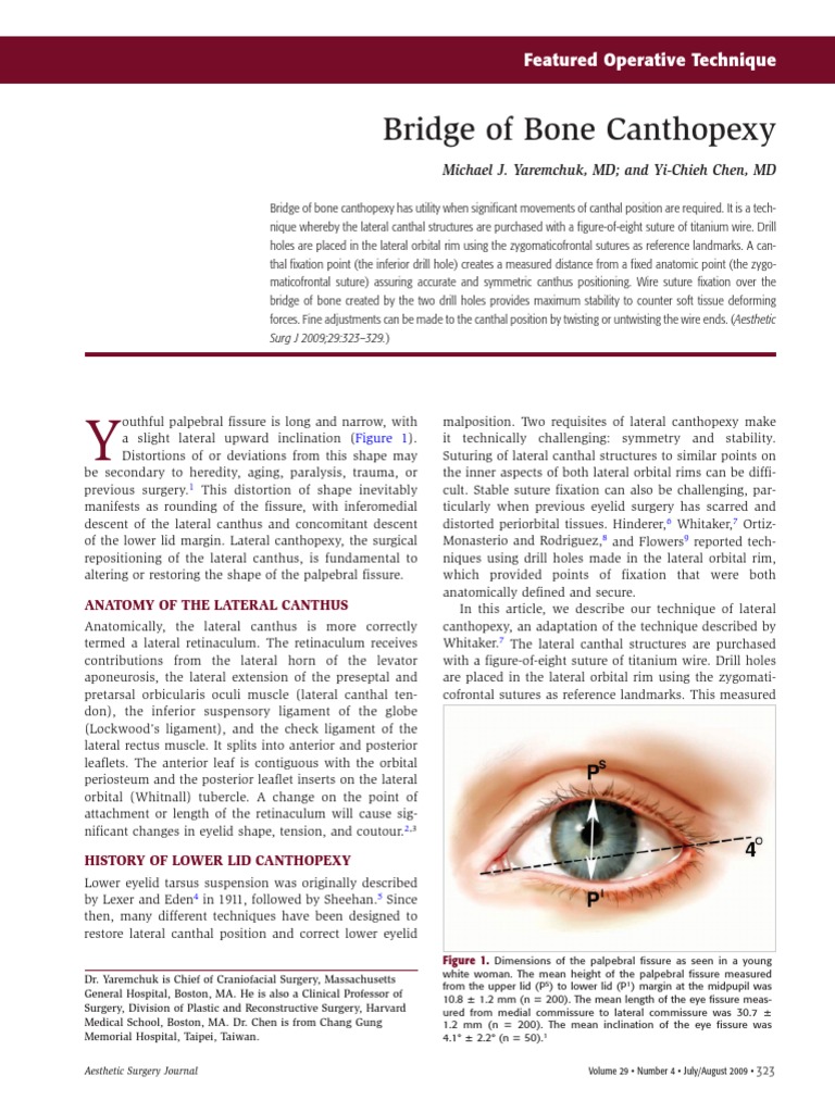 Bridge of Bone Canthopexy | PDF | Anatomical Terms Of Location ...