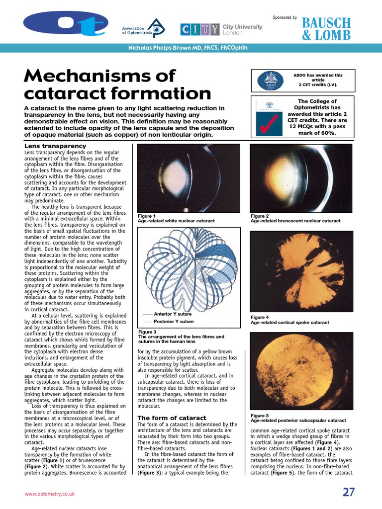 Mechanisms of Cataract Formation | PDF | Cataract | Ultraviolet